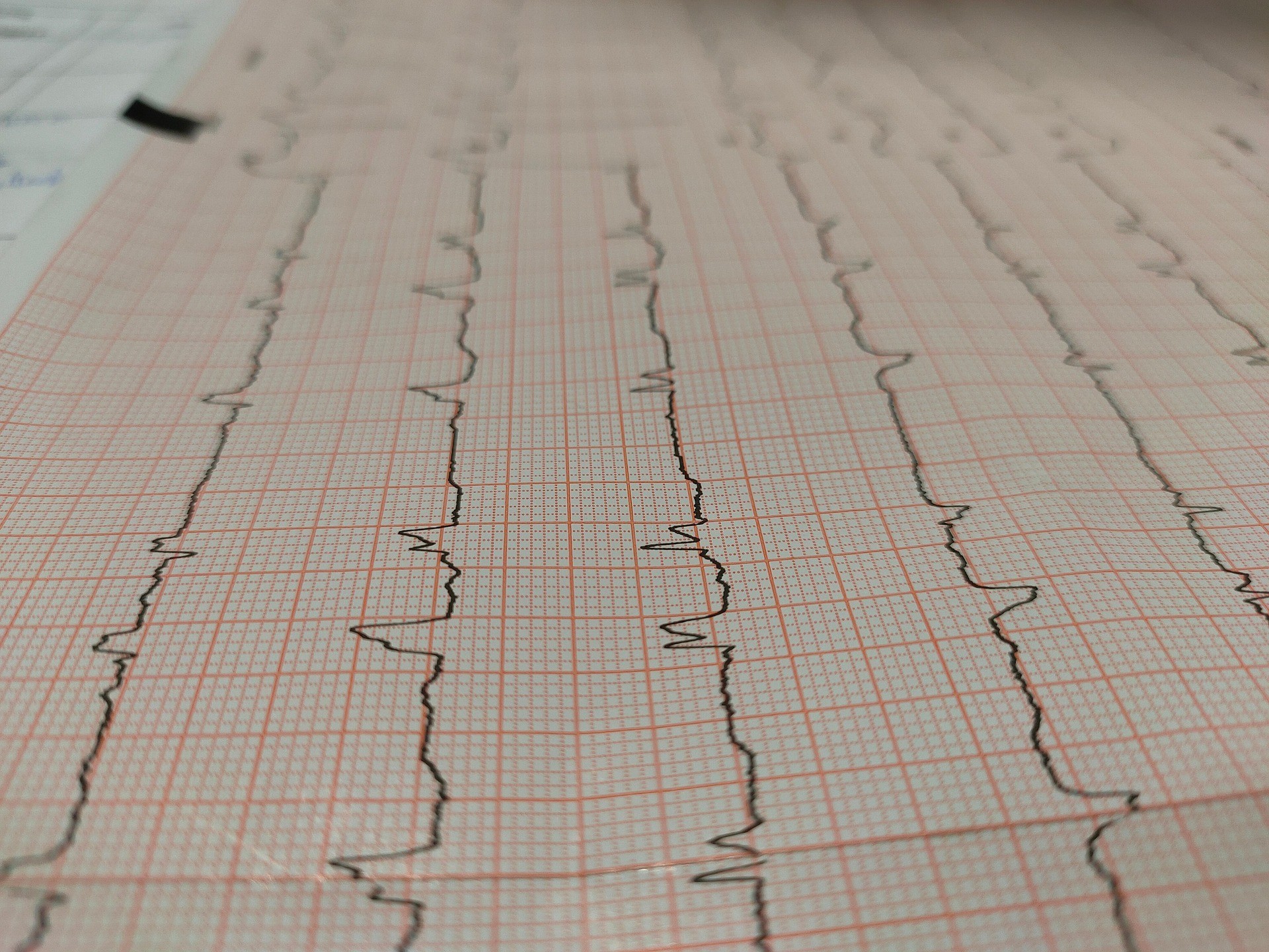 Search fund Nosara compra Telecardio, de diagnósticos remotos